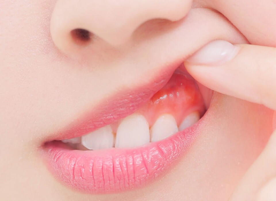 Periodontist Seal Beach | Gentle Care Dental Center